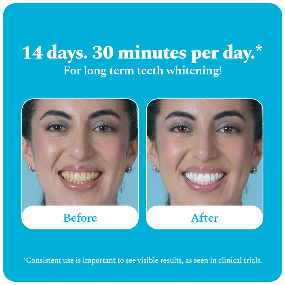 Teeth Whitening Strips – PAP-HAP+ for a Whiter Smile in 14 Days ...